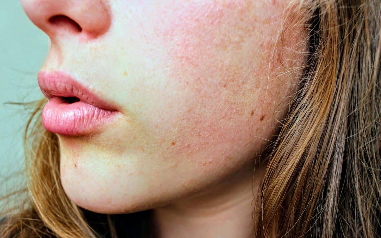 The Stages Of A Canker Sore: Everything You Need To Know